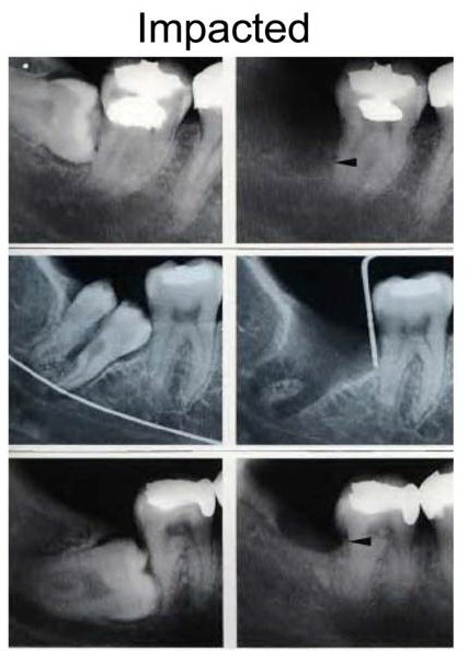 Radiologi: TEKNIK RADIOGRAFI DENTAL