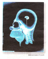 Focus Psychology: Will alcohol make your brain a "pickled walnut"