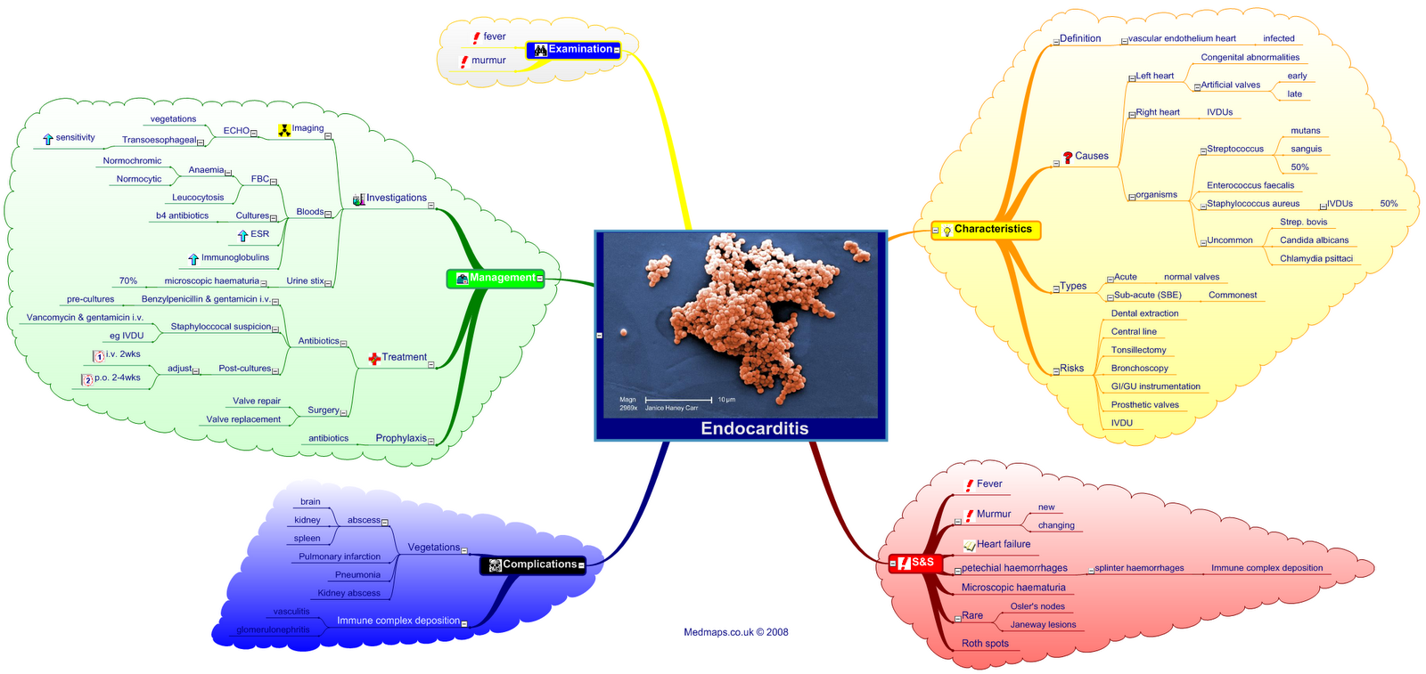 Mind map of Endocarditis