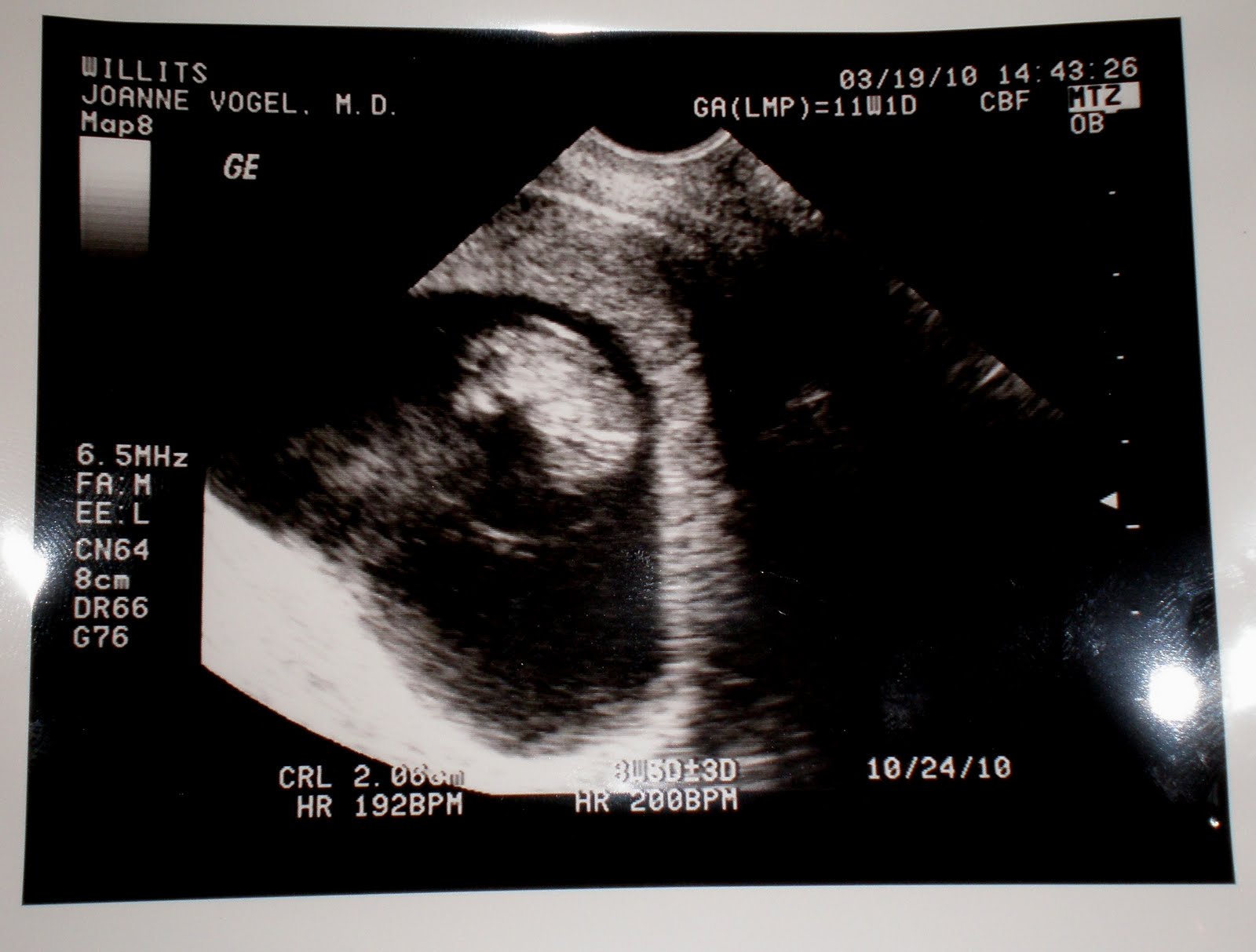 One Lucky Blind Date: 9 Week Ultrasound