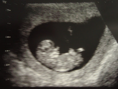 My Baby Journey: Ten (10) Week Ultrasound