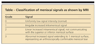 RadiologySpirit: Meniscal Tears