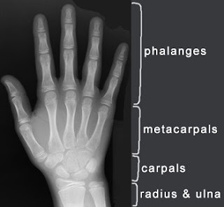 RadiologySpirit: Normal Hand and Wrist Anatomy