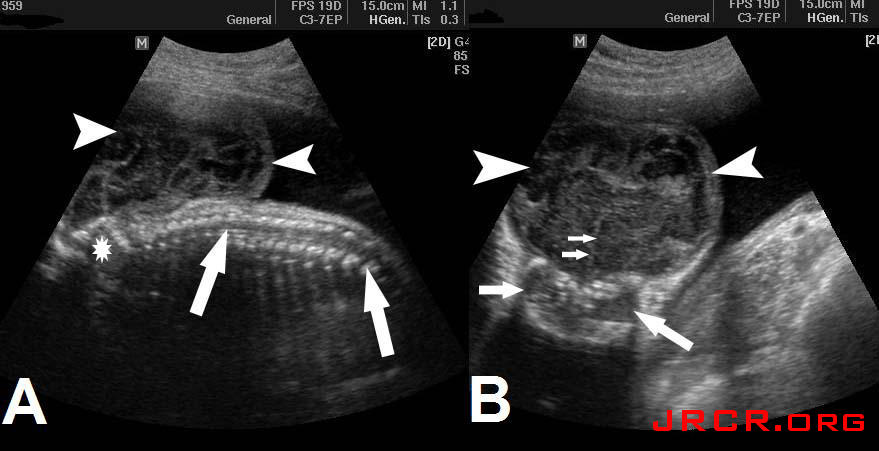RadiologySpirit: 2010-05-30