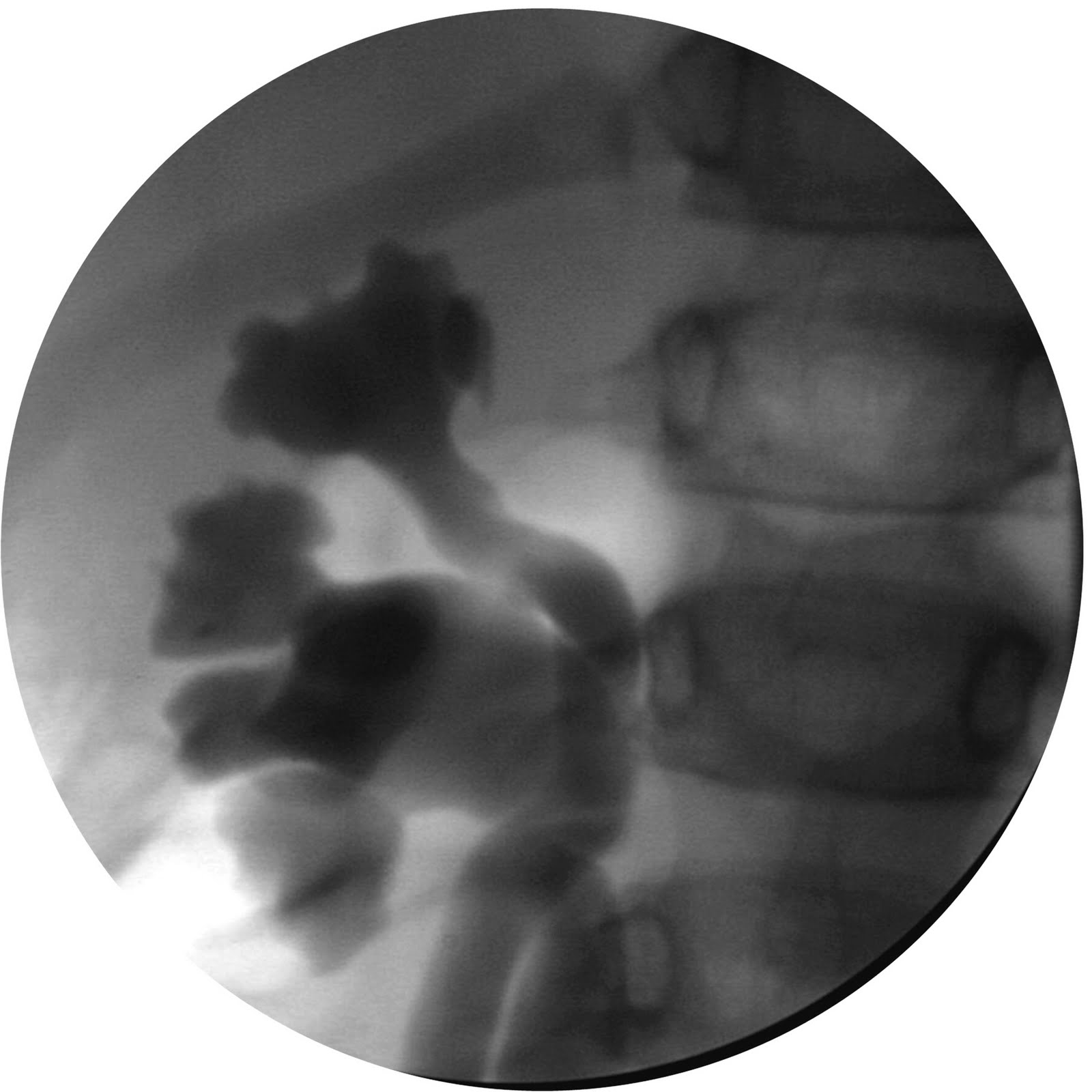 RadiologySpirit: 2010-07-04