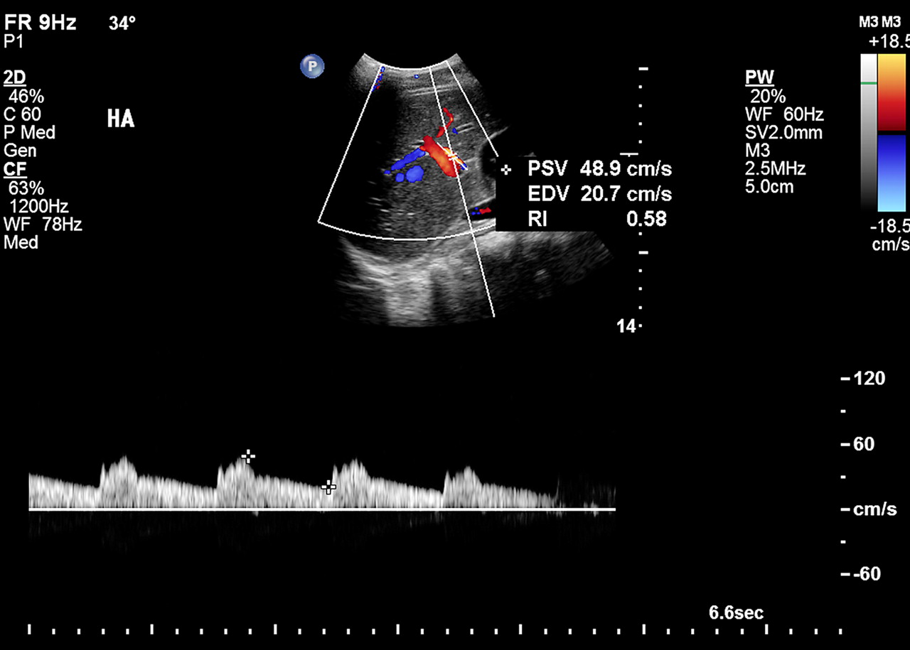 RadiologySpirit: 2010-07-04
