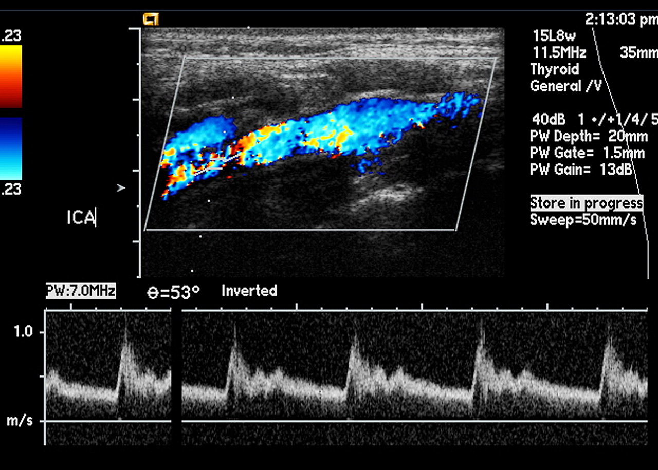 RadiologySpirit: 2010-07-04