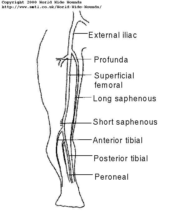 RadiologySpirit Assessing The Lower limb Veins For Incompetence RadiologySpirit Assessing The Lower limb Veins For Incompetence