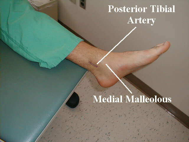 Posterior Tibial Artery