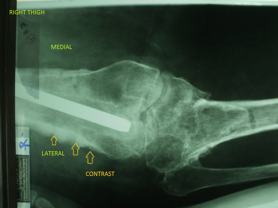 RadiologySpirit: sinogram