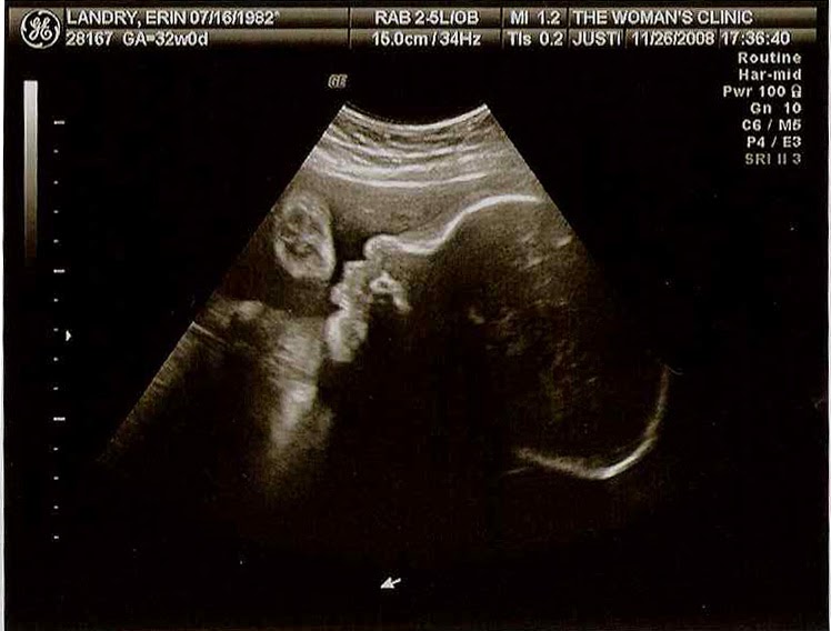 Blair's Family Blog: 32 week ultrasound!