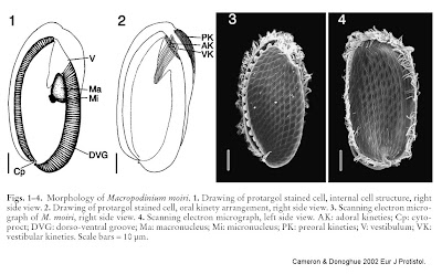 Skeptic Wonder: Sunday Protist - Litostomatea: rumen ciliates with ...