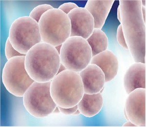 AeriSeal® Emphysematous Lung Sealant System, nuevo tratamiento para ...