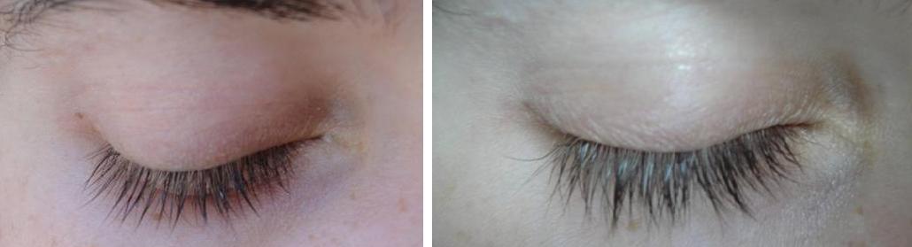 Beauty ponders: Tested L'Oreal Lash Renewal Serum