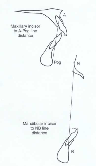 Panduan Analsis Sefalometri | Jurnal Kesehatan Lingkungan