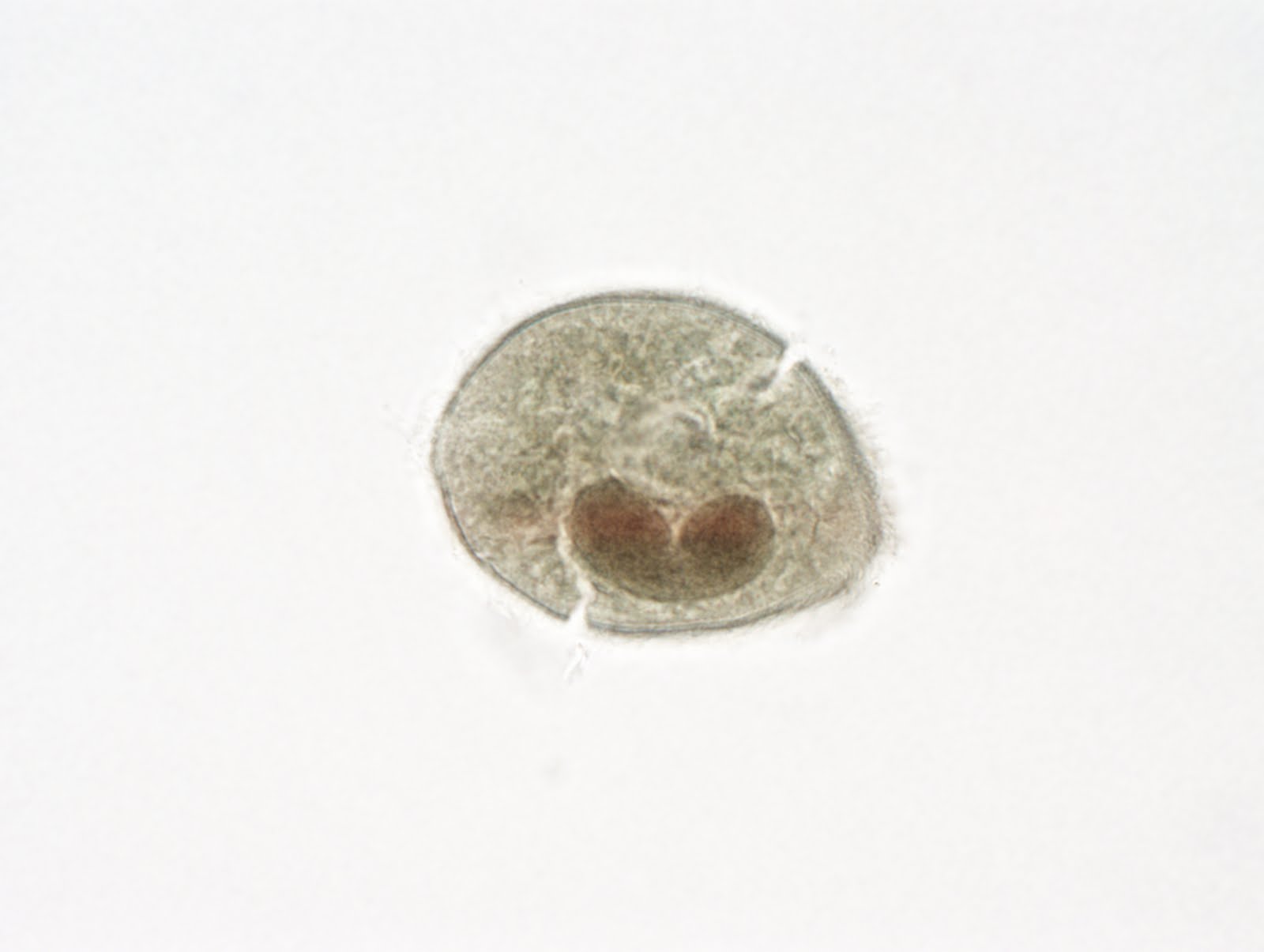 Balantidium Coli Microscope