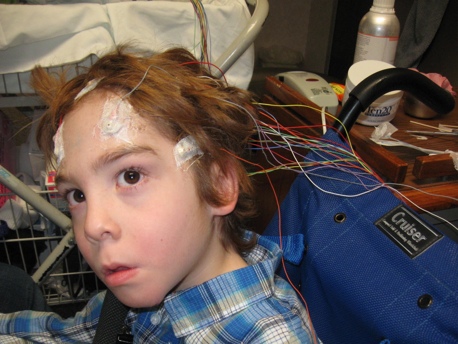 The Real Deal: Video EEG