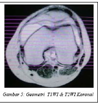 Radiologi: Magnetic Resonance Imaging (MRI)