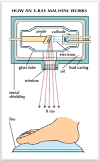 Radiologi : Terbentuknya Sinar-X pada Pesawat Sinar-X