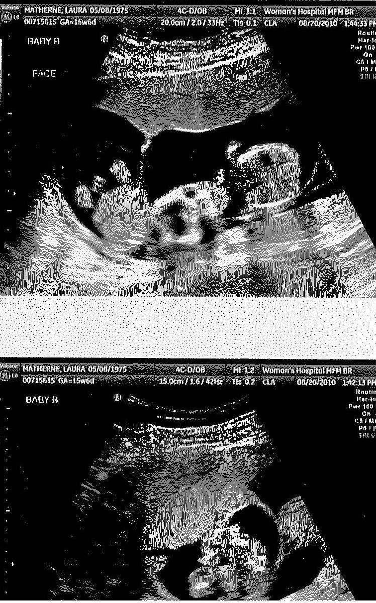 The Matherne Quads!: 16 week ultrasound - Baby B - Its a Boy!