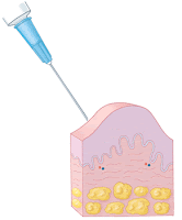 Lives dans på roser