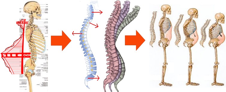 ijjjji anti aging & longevity: Posture Defeating Back Pain and Aging of ...