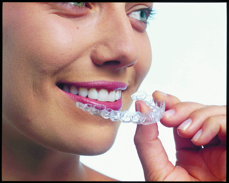 Invisalign in Stockport: Are crooked teeth zapping your confidence?