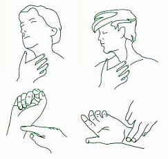 Zonas donde medir el pulso. | APUNTES AUXILIAR ENFERMERIA