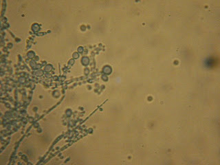 Coleção de Lâminas: Candida albicans
