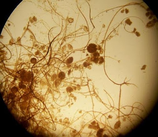 Coleção de Lâminas: Rhizopus sp