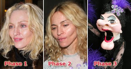 Celebrity Cosmetic Surgery: Madonna To Undergo $200,000 Worth of ...