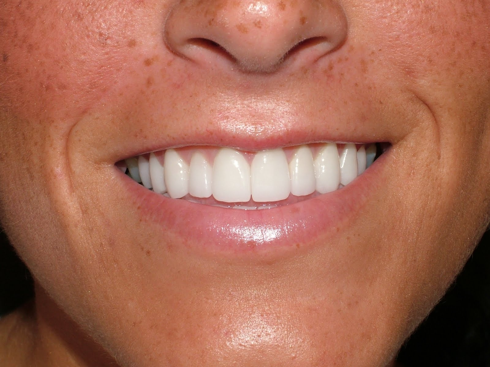 Westport Cosmetic Dentistry Blog