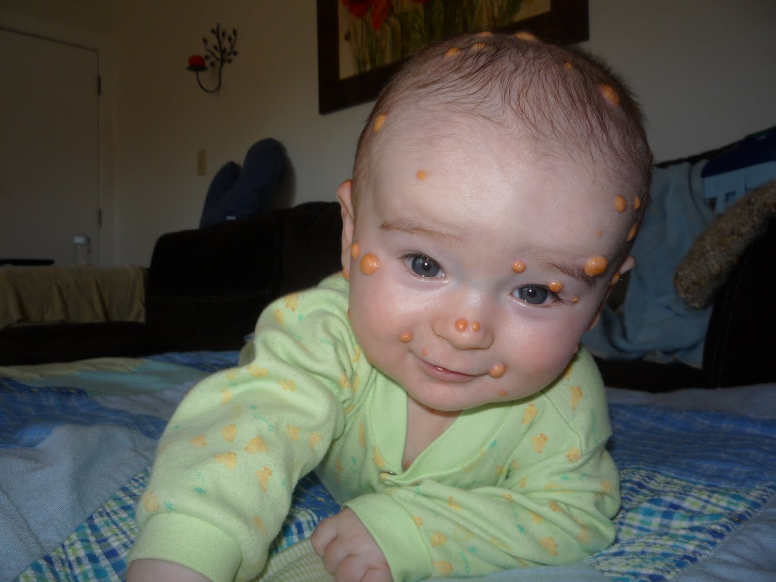 Juvenile Xanthogranuloma Online Support: MY WISH LIST (18 to 22 week old)