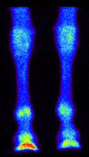 Behind the Bit: Bone scans: Putting your horse on the "hot" seat