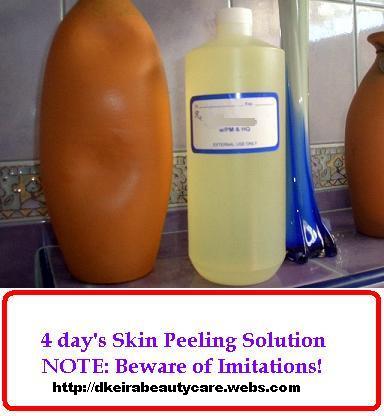 The Wonder's of Whitening Peeling Solution: The Wonder's of Whitening ...