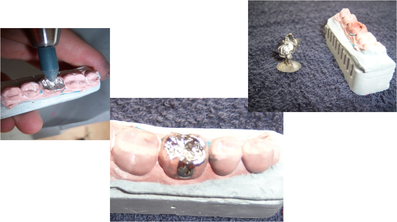 Biomateriales Dentales