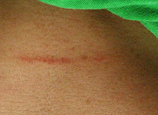 What to Wear Running: Running and Chafing