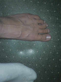 A Little Off the Top: Cross Your Fingers, Cross Your Toes?