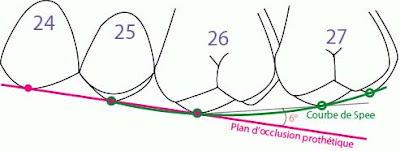 Le montage des dents