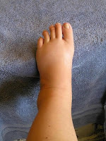 Boring Blog-O-Beth: Cankles