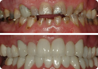 Dr. Nikhil's Microdentistry: Cosmetic Dentistry