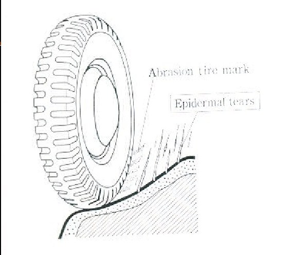 Review of Forensic Medicine: AIIMS MD Entrance Exam November 2010
