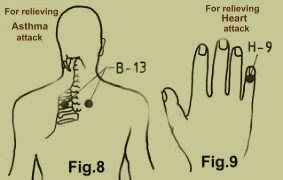 ACUPRESSURE AND ACUPUNCTURE THERAPY: Important points for relieving ...