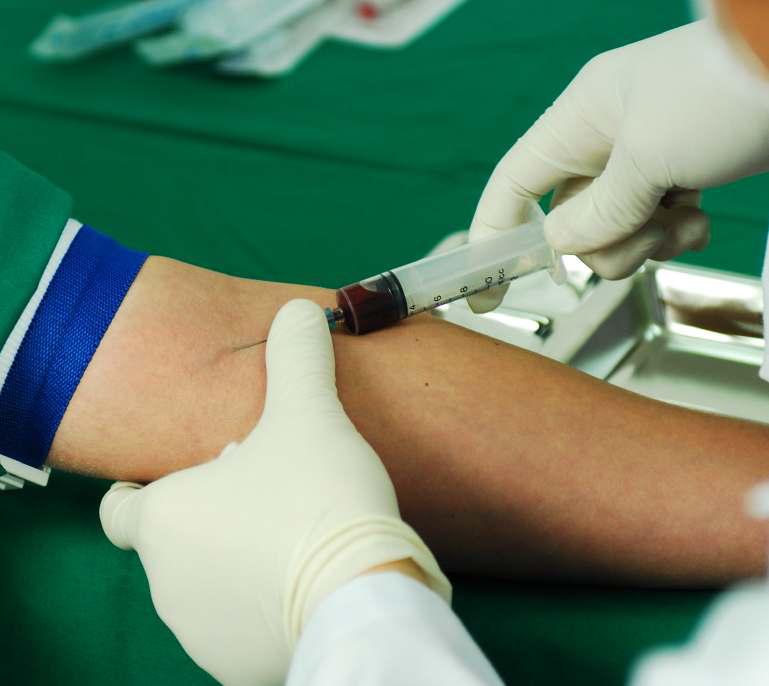 Atasi Kebotakan dengan Darah Anda Sendiri: Pembuatan PRP