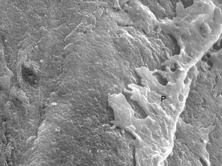 Blood vessels of eyes: Pericyte process and fenestrated endothelial ...