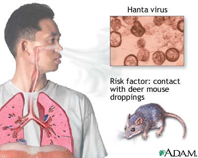¡BIENVENIDOS AMIGOS!: Hantavirus