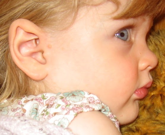 Accessorizing with Ears