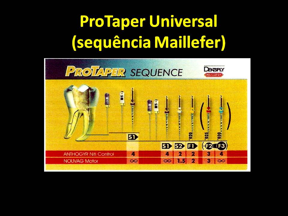 Endodontia Dr. Henrique Braitt: Sequência ProTaper Universal (Original ...