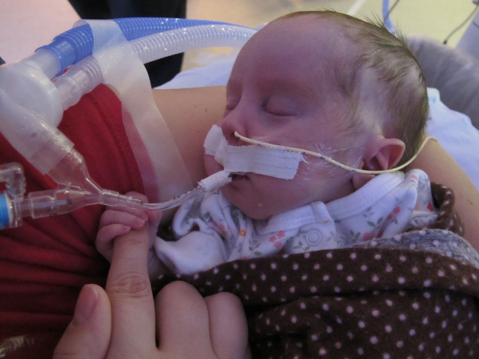 Natalie Evelyn: One Month Old and....Extubated!!!