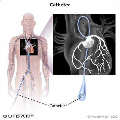 Angelite Nurses: Cardiac Catheterization